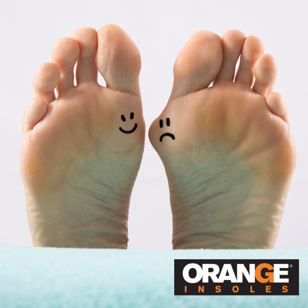 What to Do if You're Out-Toeing (Duck-Footed)? – Orange Insoles
