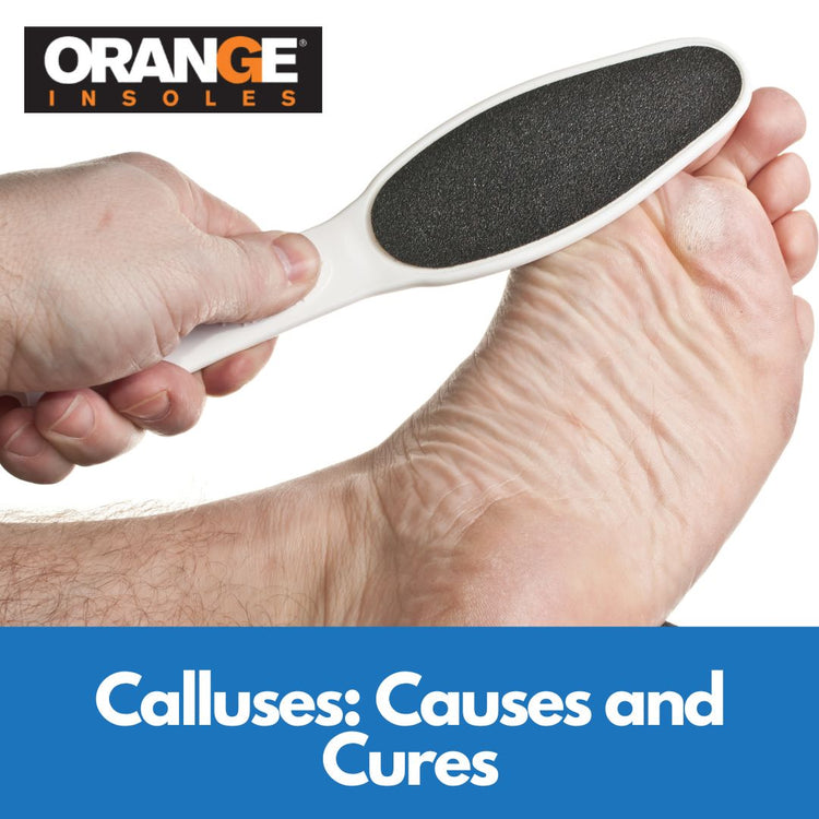 Calluses: Causes and Cures – Orange Insoles